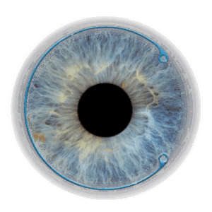 Capsular Tension Rings | Lenstec